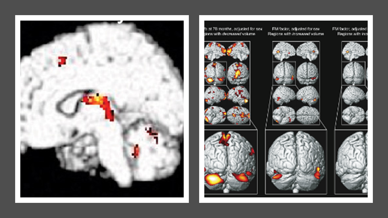 That Water You Drink Might be Poisoning Your Family With Lead