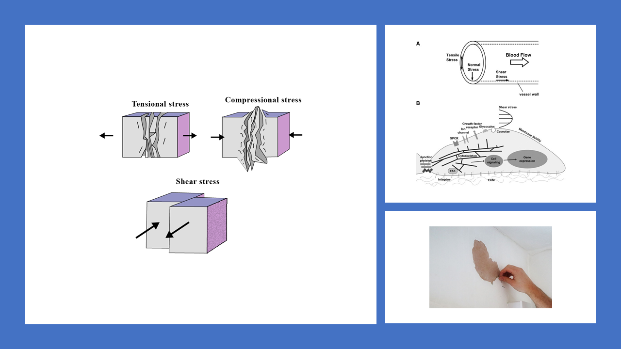 von Willebrand’s Disease: When Bleeding Doesn’t Stop