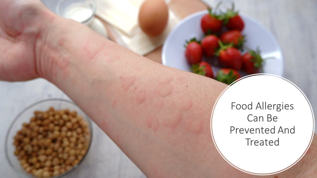 Food Allergy Freedom: Proven Ways for Prevention and Treatment